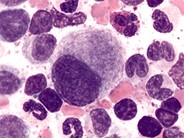 Micromegakaryocyte - 1.