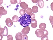 Basophil - 1.