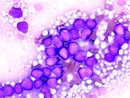 Ph+ ALL− Touch Prep - 1.