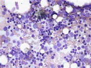 Erythroid Hyperplasia 1