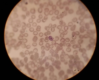 Schizont , Plasmodium vivax