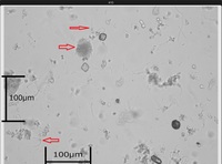 SPHEROPLASTS : PSEUDOSPERMATOZOA : IMAGE 6